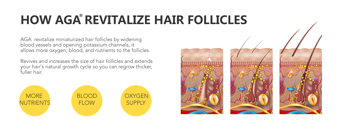 AGA - HAIR REGROWTH TREATMENT